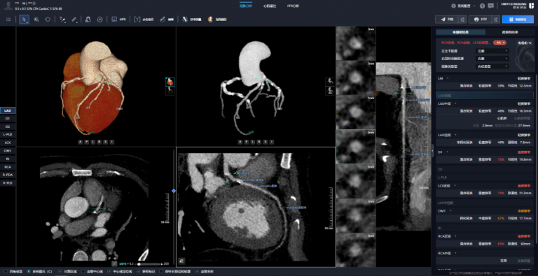 【智慧医疗】AI辅助诊断系统赋能，揭开精准医疗诊断新篇章 – 合浦县人民医院